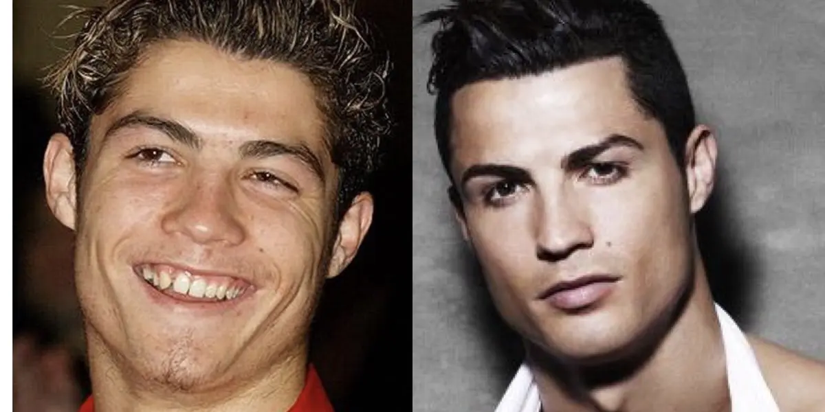 Did Cristiano Ronaldo undergo plastic surgery? The evidence that ...
